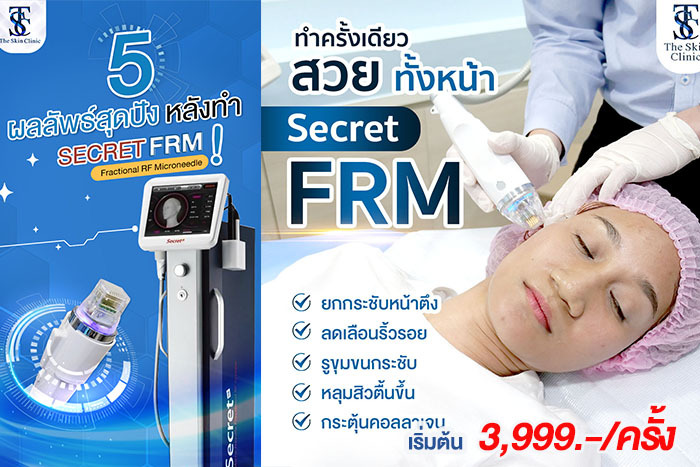 Secret FRM ยกกระชับ ปรับหน้าเรียว